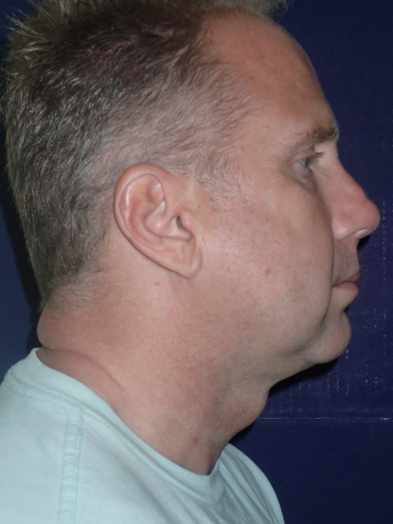 OLYMPUS DIGITAL CAMERA - Casey Cosmetic Surgery | Facial and Body Surgery